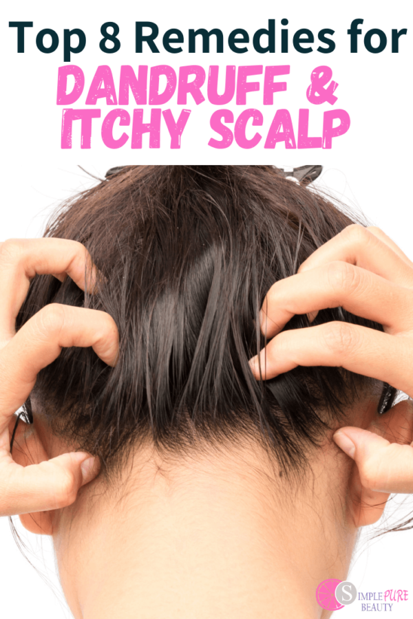 Top 8 Natural Home Remedies For Dandruff And Itchy Scalp Simple Pure